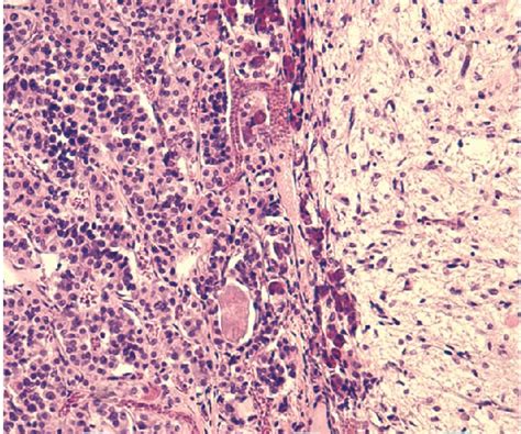 Microscope Pituitary Diagram Quizlet