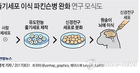 그래픽 줄기세포 이식 파킨슨병에 효과 연구 모식도