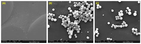 Prospects On Tuning Bioactive And Antimicrobial Denture Base Resin