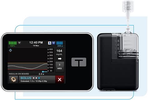 Tandem Mobi Insulin Pump Review
