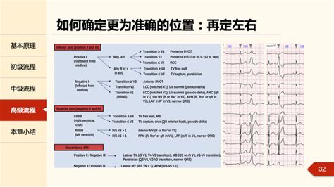 室性早搏如何进行体表心电图定位 好医术文章 好医术 赋能医生守护生命