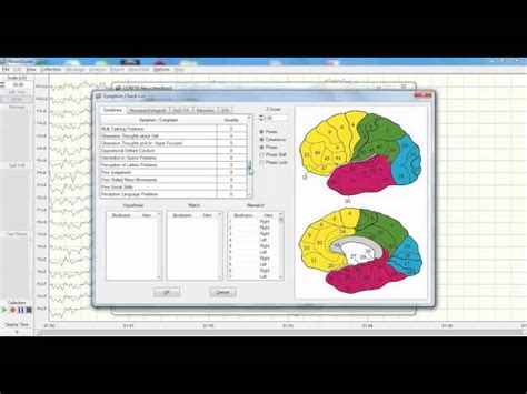 Loreta Brain Mapping Top Sellers