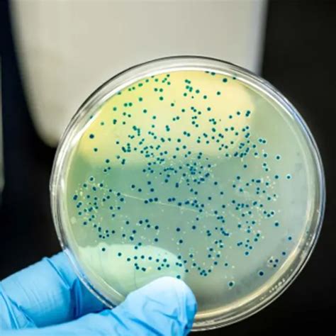 Brucellosis Test Price In Delhi Ganesh Diagnostic