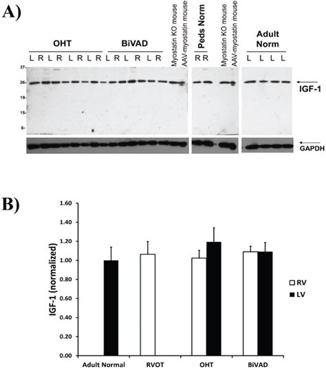 Igf 1 Expression A Representative Western Blot For Igf 1 Expression