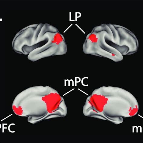 Pcl R List Items Broken Down By Factor Factor 1 Download Table