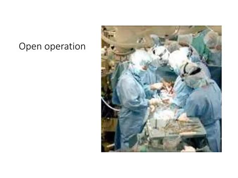 Obstructive Uropathy 1 Pptx Medical Health