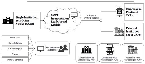 Brief Review — Chexternal Generalization Of Deep Learning Models For Chest X Ray Interpretation