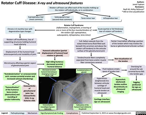 Rotator Cuff Disease X Ray And Ultrasound Features Calgary Guide