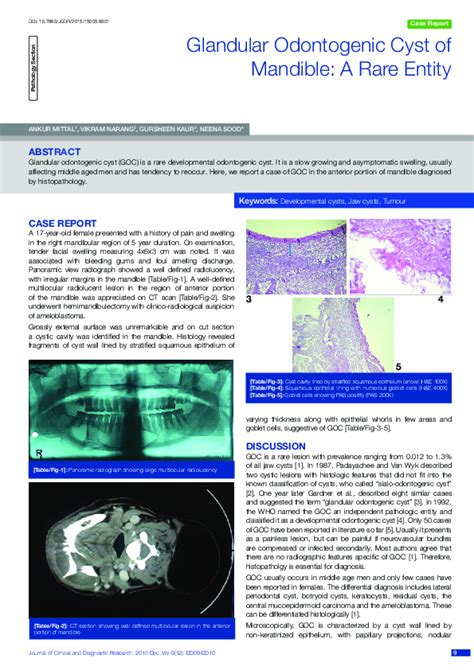 Pdf Glandular Odontogenic Cyst Of Mandible A Rare Entity Vikram Narang