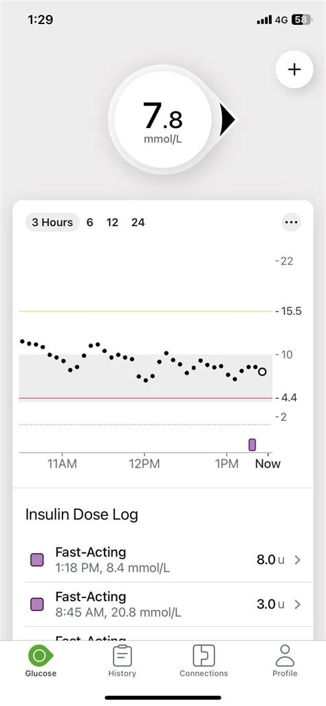 Dexcom Readings Rtype1diabetes