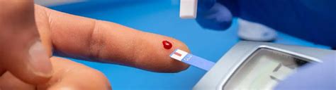 Wolfram Syndrome Causes Symptoms Diagnosis And Treatment