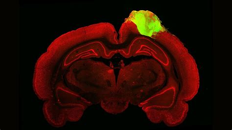Cerebral Organoids What Are Lab Grown Minibrains Live Science
