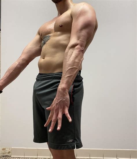 Spider Veins 🕸💪🏼 Scrolller