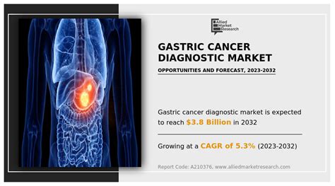 Gastric Cancer Diagnostic Market Statistics Forecast 2032