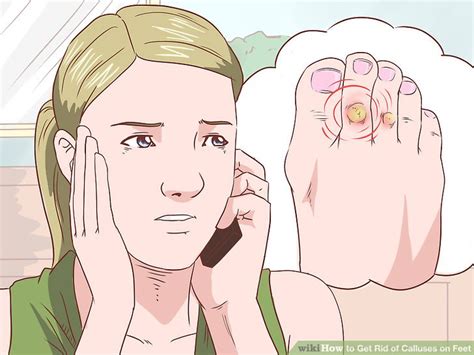 3 Ways To Get Rid Of Calluses On Feet WikiHow