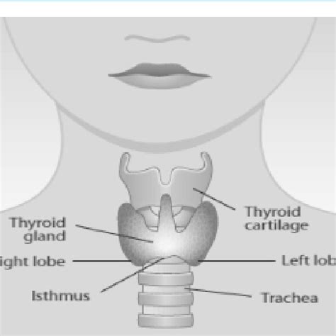 Shows Lt Lobe Of Thyroid Gland With A Large Fluid Filled Cystic Mass