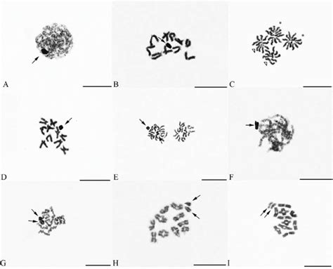 Berinda Hakani A Pachytene B Diplotene C Anaphase Ii N 12 And