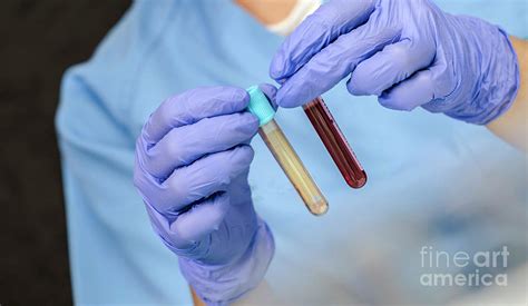 Separated Blood Samples By Science Photo Library