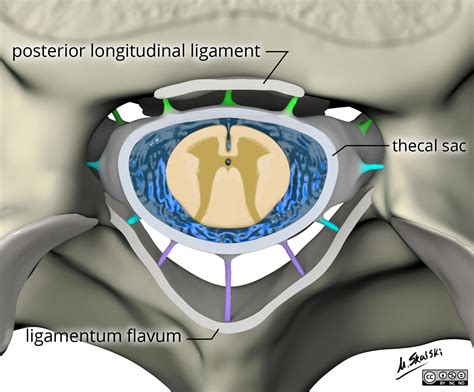 Radiopaedia Drawing Ligamentum Flavum Posterior Longitudinal