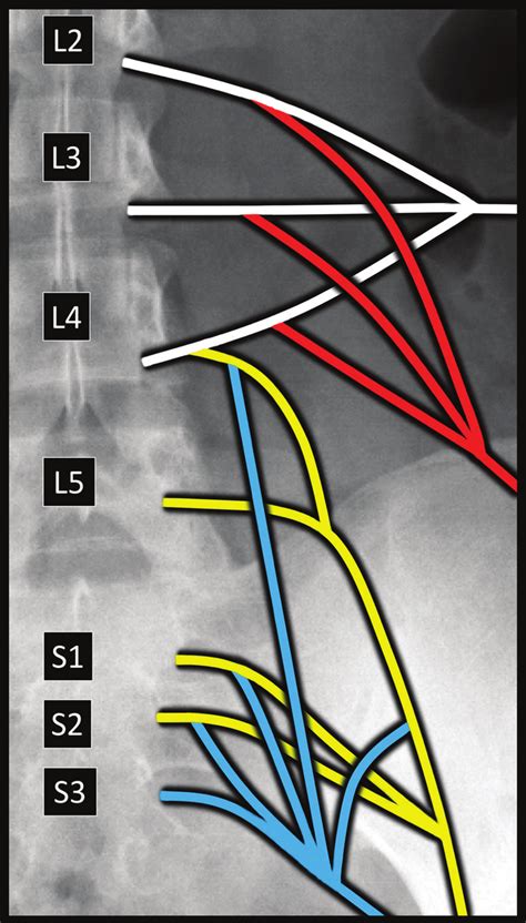The Lumbosacral Plexus A Schematic Demonstrating The Lumbosacral Download Scientific Diagram