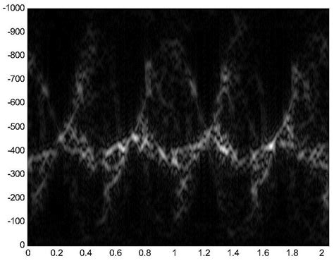 Classification And Identification Method For Pedestrian And Vehicle Micro Motion Targets