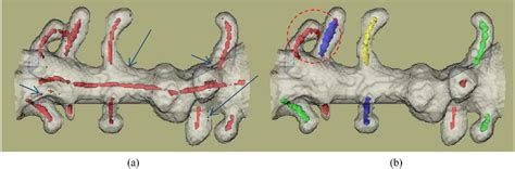 Figure 1 From A Neurocomputational Method For Fully Automated 3d Dendritic Spine Detection And