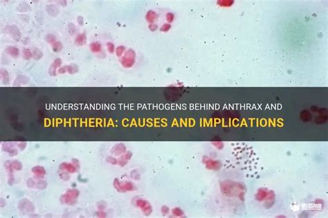 Understanding The Pathogens Behind Anthrax And Diphtheria Causes And Implications Medshun