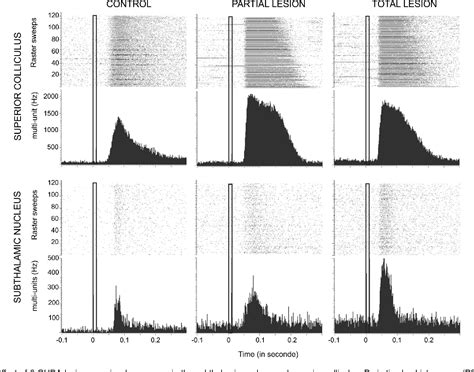 Figure 3 From Enhanced Visual Responses In The Superior Colliculus And Subthalamic Nucleus In An