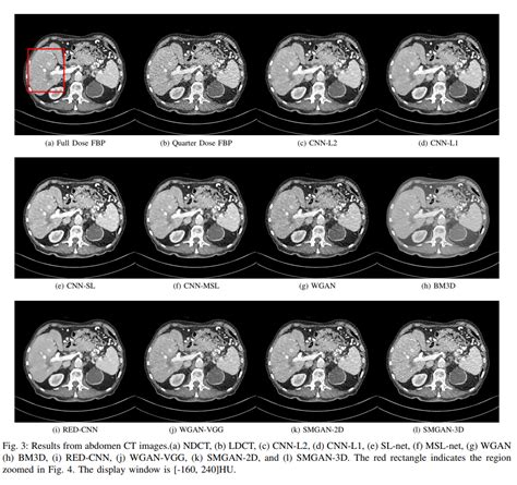Github Growingfuturestructure Sensitive Multi Scale Deep Neural