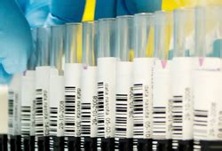 Tiêu chuẩn ISO TS Thông số kỹ thuật về mã vạch trên bao bì thuốc Apex Đỉnh Thiên