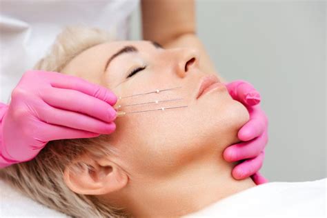 Pdo Threads Treatment In Walnut Creek And Pleasanton Ca