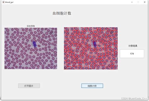 基于matlab的细胞计数图像处理系统 Gui界面有报告 【含matlab源码 Mx 003期】