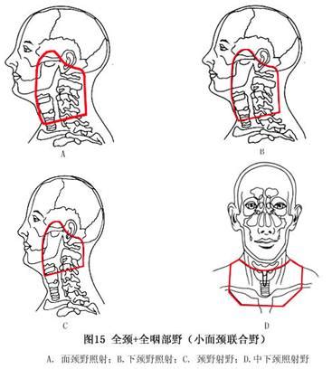 淋巴结转移癌手绘图 正常人了淋巴结图片 淋巴结图片 第2页 大山谷图库