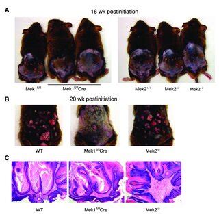 Skin Restricted Mek1 Knockout Mice But Not Mek2 Knockout Mice Are Download Scientific Diagram