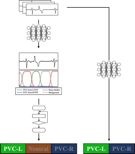 Explainable Localization Of Premature Ventricular Contraction Using
