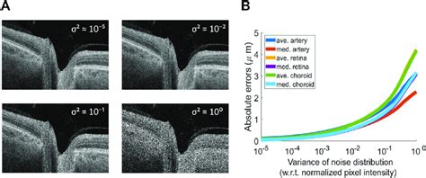 Gaussian And Speckle Noise Distributions Were Applied To Test The Download Scientific Diagram