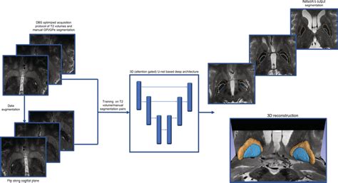 Proposed Gp‐net For The Automatic And Patient‐specific Segmentation Of Download Scientific