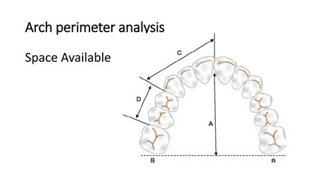 Cast Analysis 2pptx