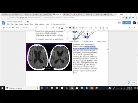 The Extreme Learning Machine Algorithm Theory And Applications