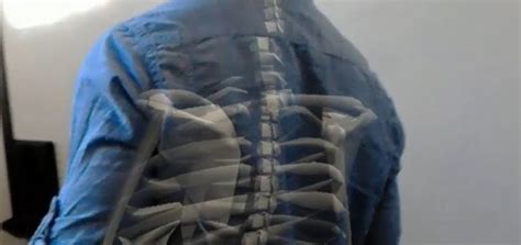 Hololens Projection Shows Your Skeleton Inside