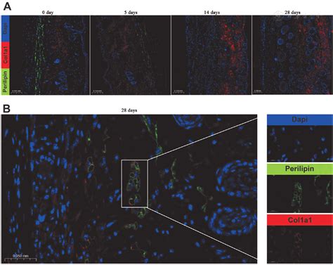 Spatial Transcriptomic Analysis Deciphers Adipocyte To Fibroblast