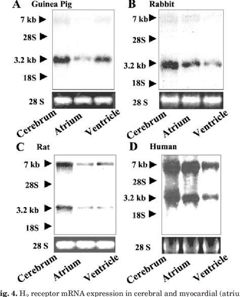 Figure 4 From Histamine H1 And H2 Receptor Gene And Protein Levels Are Differentially Expressed