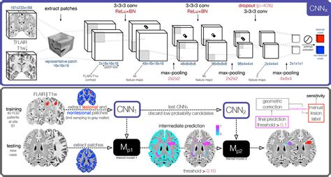 Deep Convolutional Networks For Automated Detection Of Epileptogenic Brain Malformations