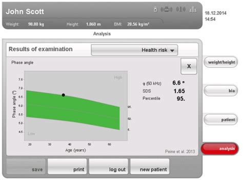 What Is Phase Angle Seca