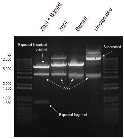 Supercoiled Plasmid Dna Gel Electrophoresis At Myesha Litherland Blog
