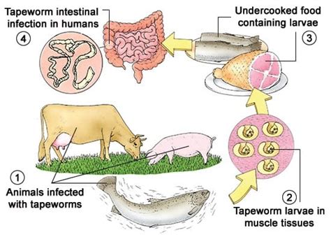 Tapeworm