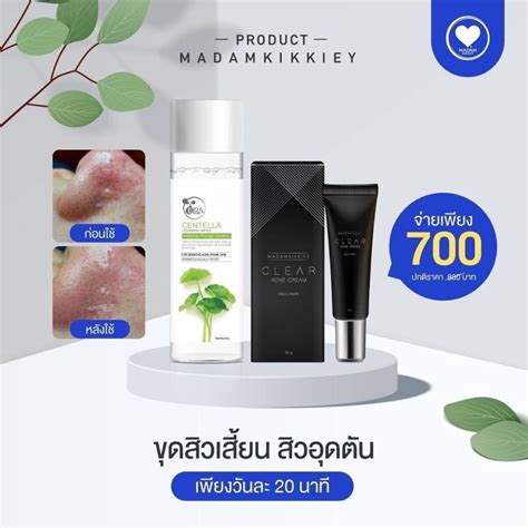 Benzacac เบนแซค เอซี 2 5 5be N Zac Ben Za C ขนาด 15g 60g ชุดกำจัดสิว