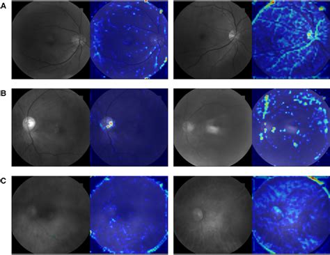 An Example Picture Showing The Attention Heat Map Of Resnet50 The Download Scientific Diagram