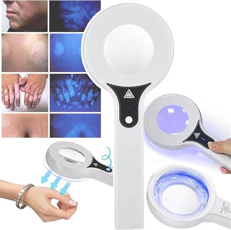 Woods Lamp Skin Analyzer Professional Uv Magnifying Analyzer For Skin