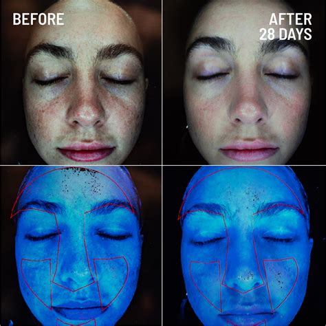Age Defying Face Exfoliator Microdermabrasion Dr Brandt Skincare